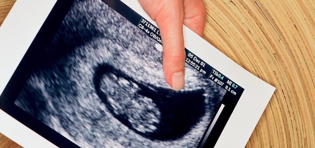 Your Guide to First-Trimester Tests and Screenings - Twill Care