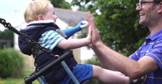While His Son Grew Up with One Arm, He Set Out to Make Another