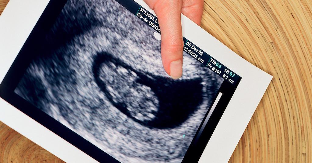 Your Guide to First-Trimester Tests and Screenings - Twill Care